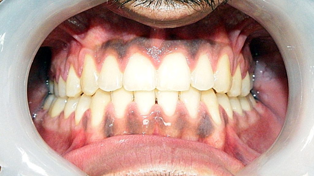 Gallery The Ortho Studio